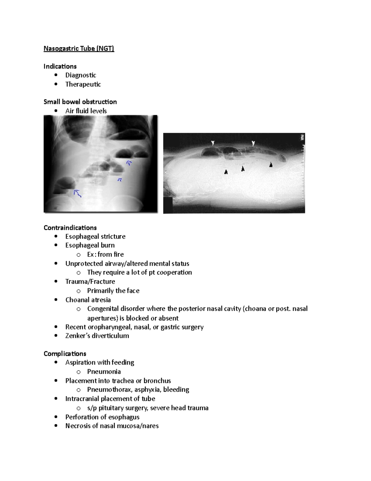 Nasogastric Tube - nasal apertures) is blocked or absent Recent ...
