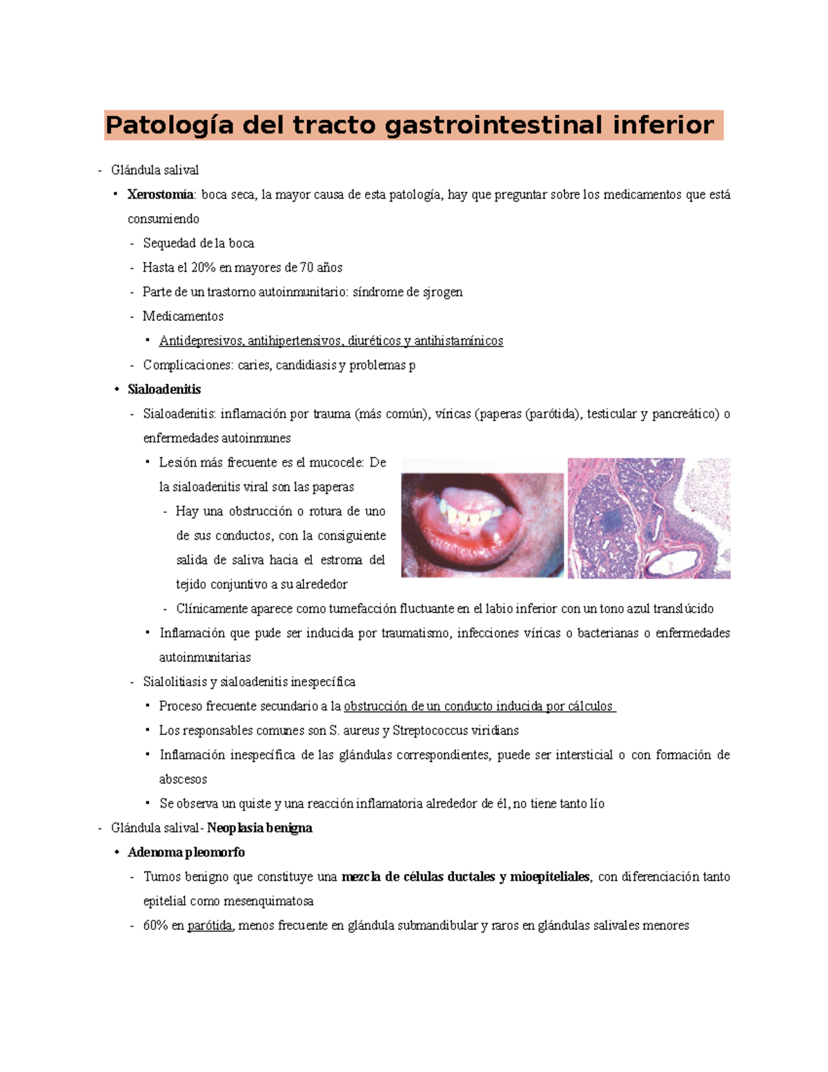 Patología del tracto gastrointestinal inferior - Patología del tracto ...