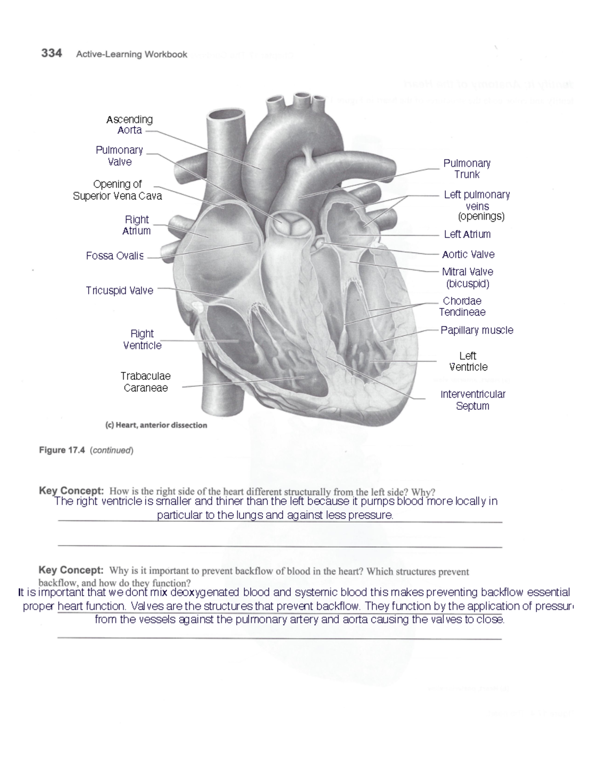 EKG HEART - EKG - Aorta Pulmonary Trunk Left pulmonary veins Left ...