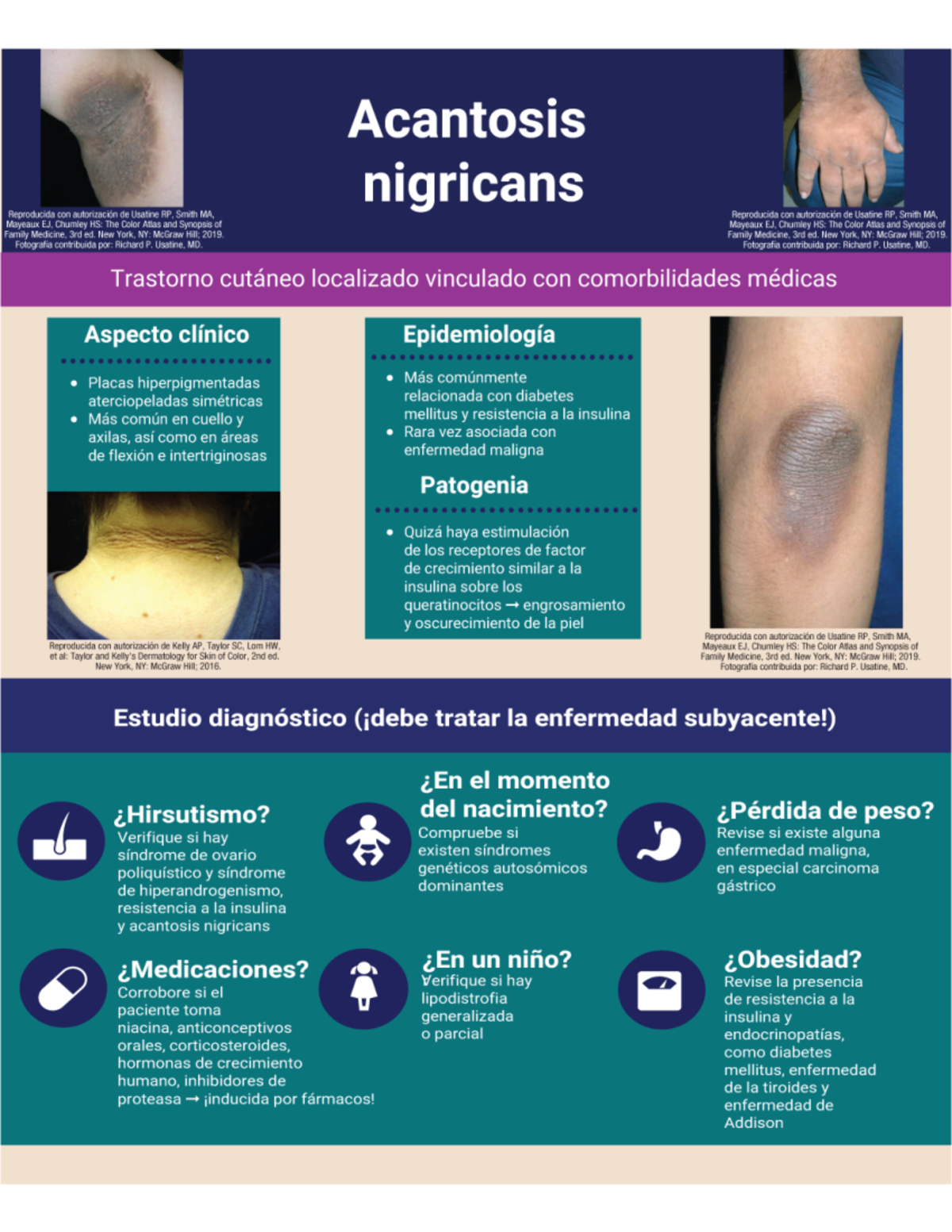 Infografia sobre Acantosis Nigricans - Infectología y Dermatología ...