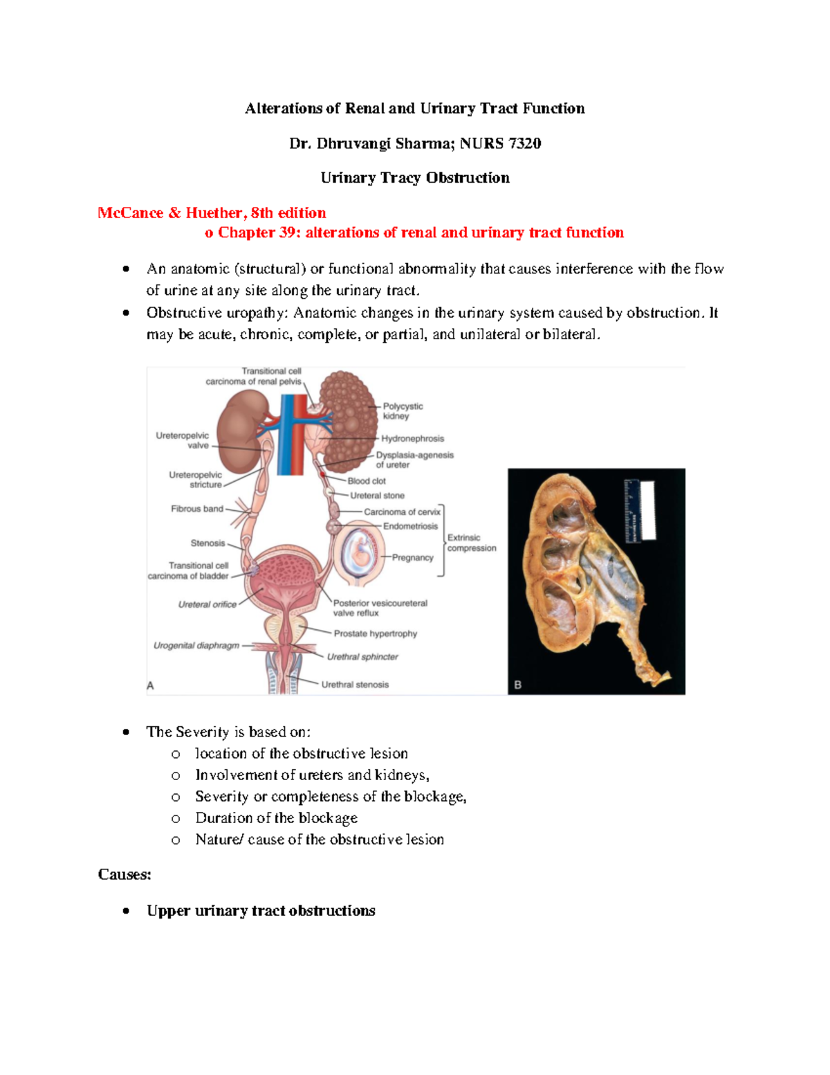 Renal Alteration Part 1 - Alterations of Renal and Urinary Tract ...