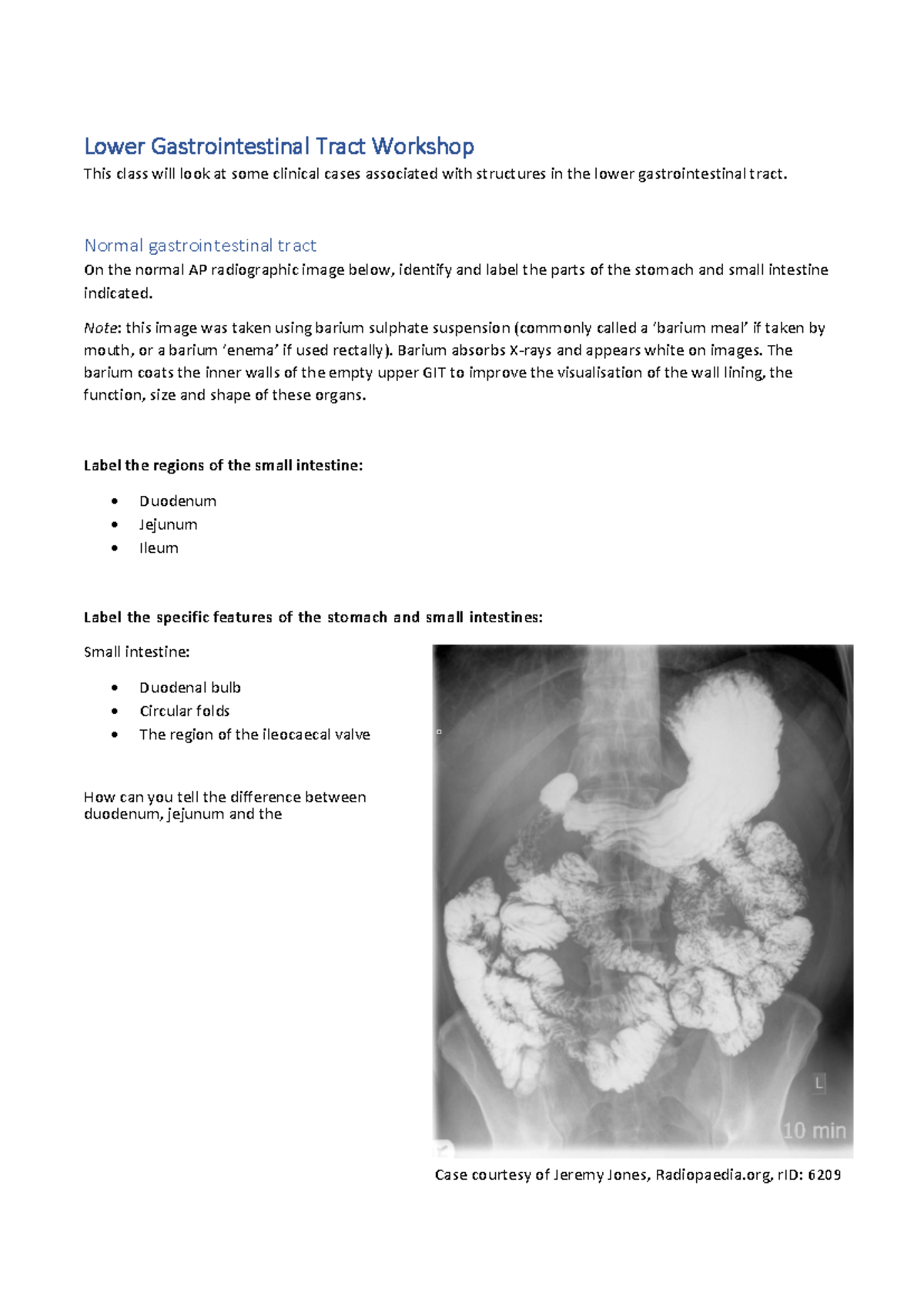 ANAT3007 Lower GIT Workshop 2024 - Lower Gastrointestinal Tract ...