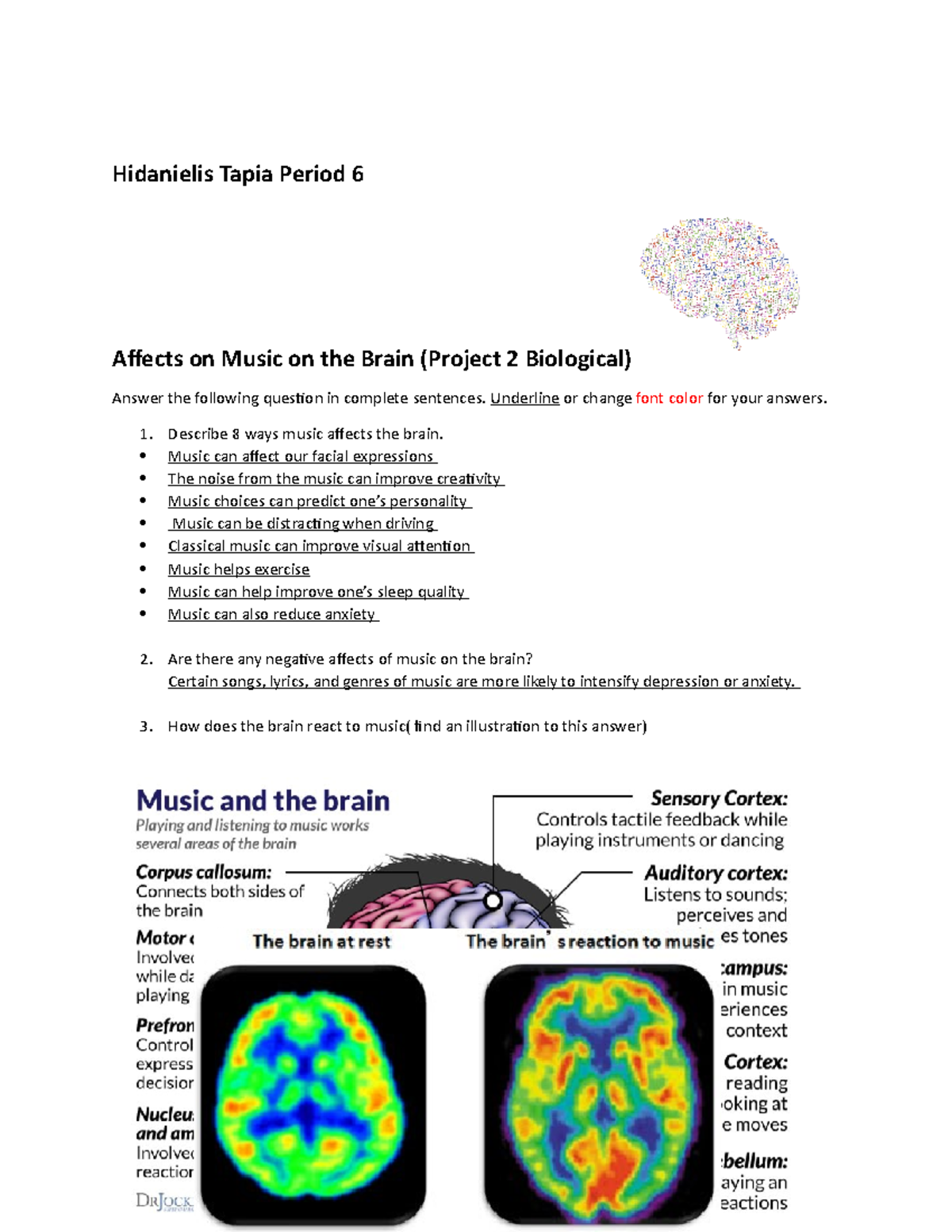Affects on Music on the Brain Per 6 - Hidanielis Tapia Period 6 Affects ...