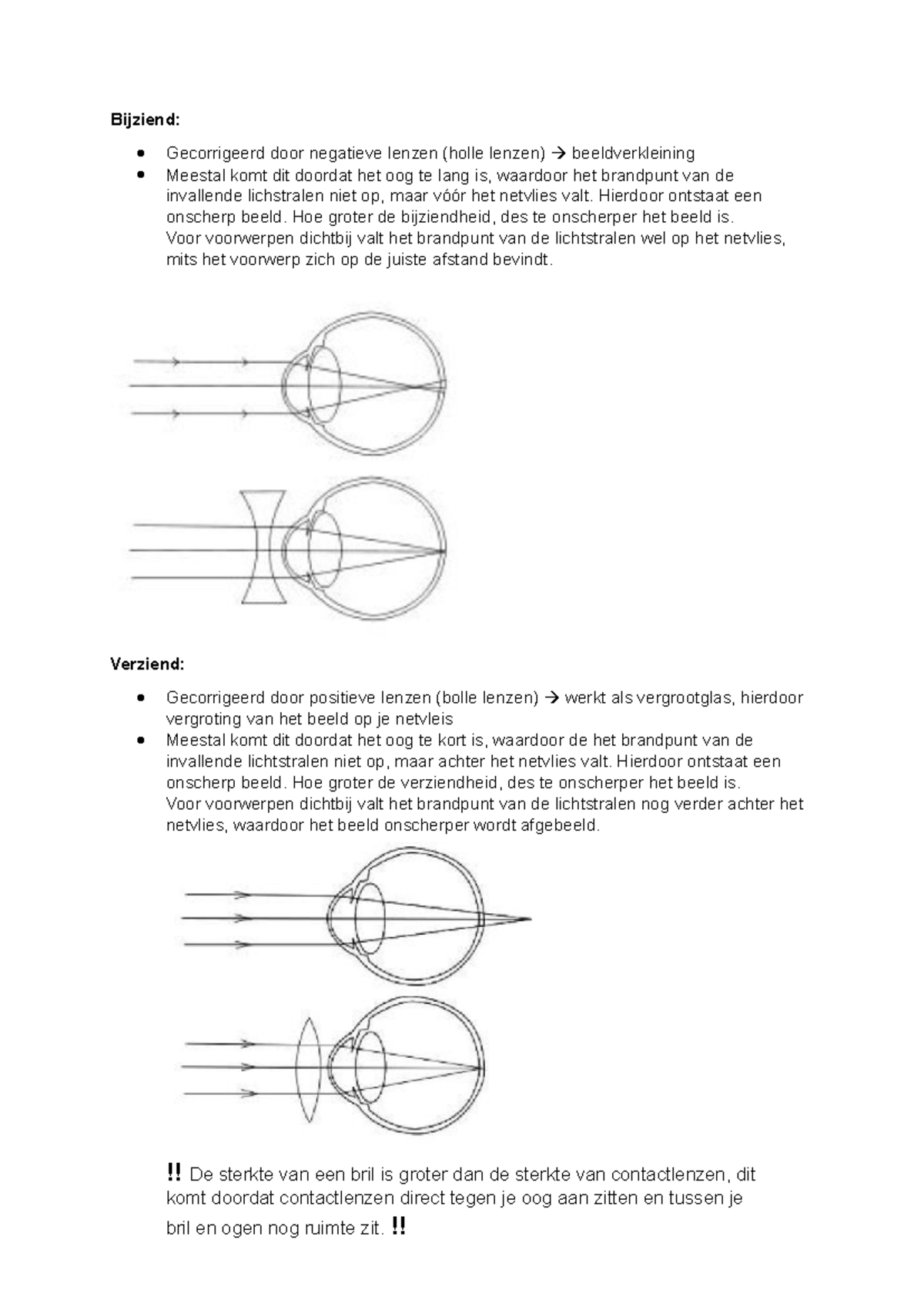 Verschil bijziend en verziend - Bijziend: Gecorrigeerd door negatieve ...