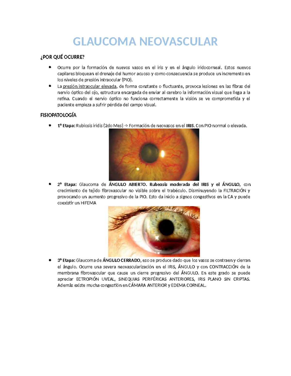 Glaucoma Neovascular - GLAUCOMA NEOVASCULAR ¿POR QUÉ OCURRE? Ocurre por la formación de nuevos ...