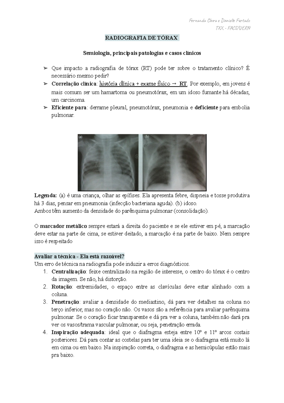 Raio X de Tórax - TXX - FACS/UERN RADIOGRAFIA DE TÓRAX Semiologia ...