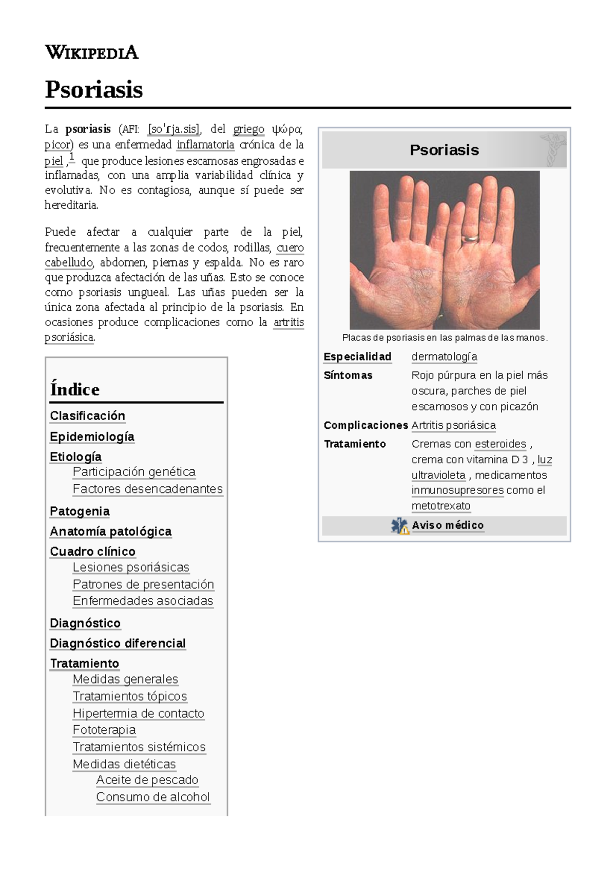 Psoriasis - sadasd - Psoriasis Placas de psoriasis en las palmas de las ...