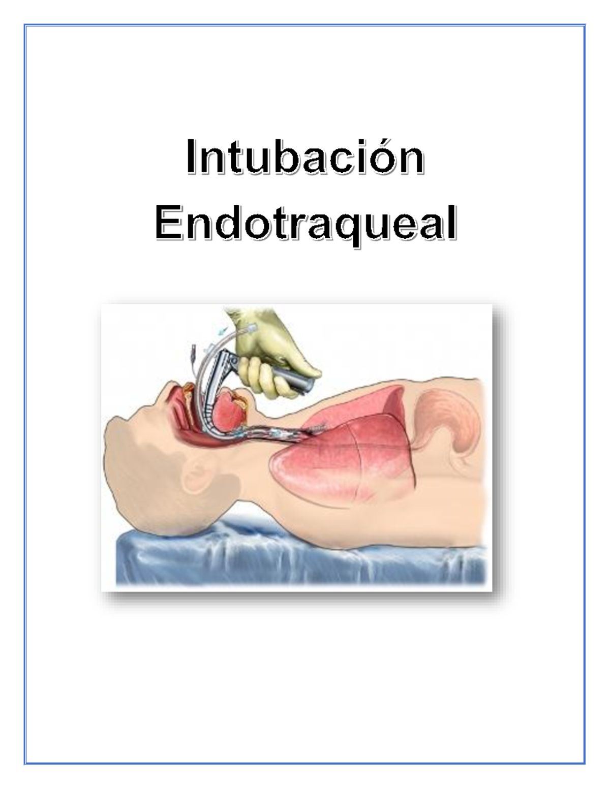 Intubación Endotraqueal - Enfermería General 6° A Matutino Enfermería ...