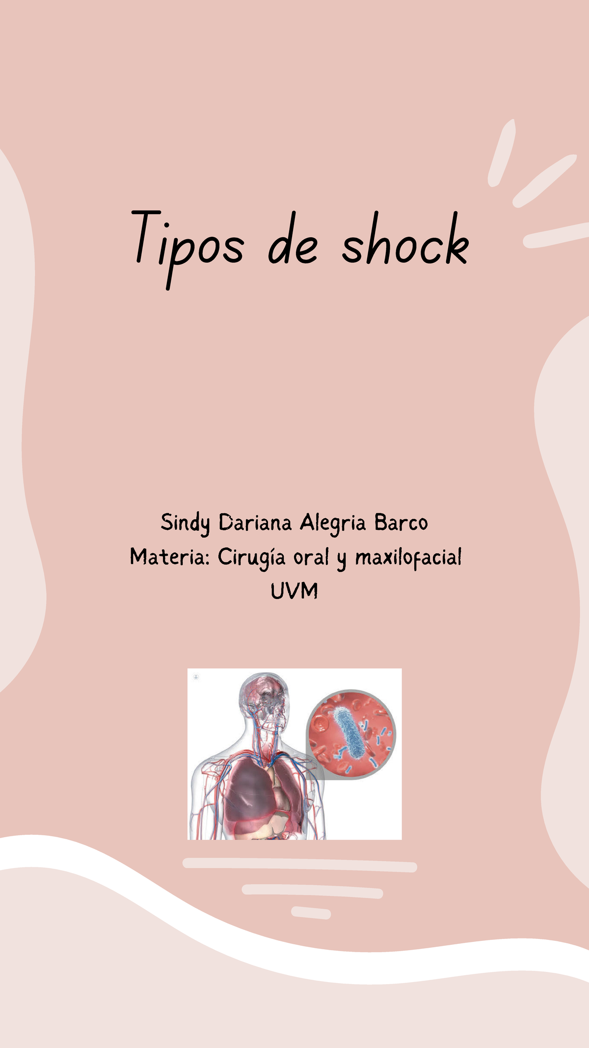 Tipos de Shock - Resumen de la materia - Tipos de shock Sindy Dariana Alegria Barco Materia ...