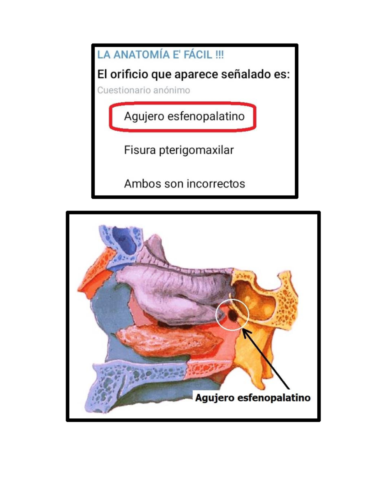 Agujero Esfenopalatino - . Hueso palatino (os palatinum) aspecto medial ...