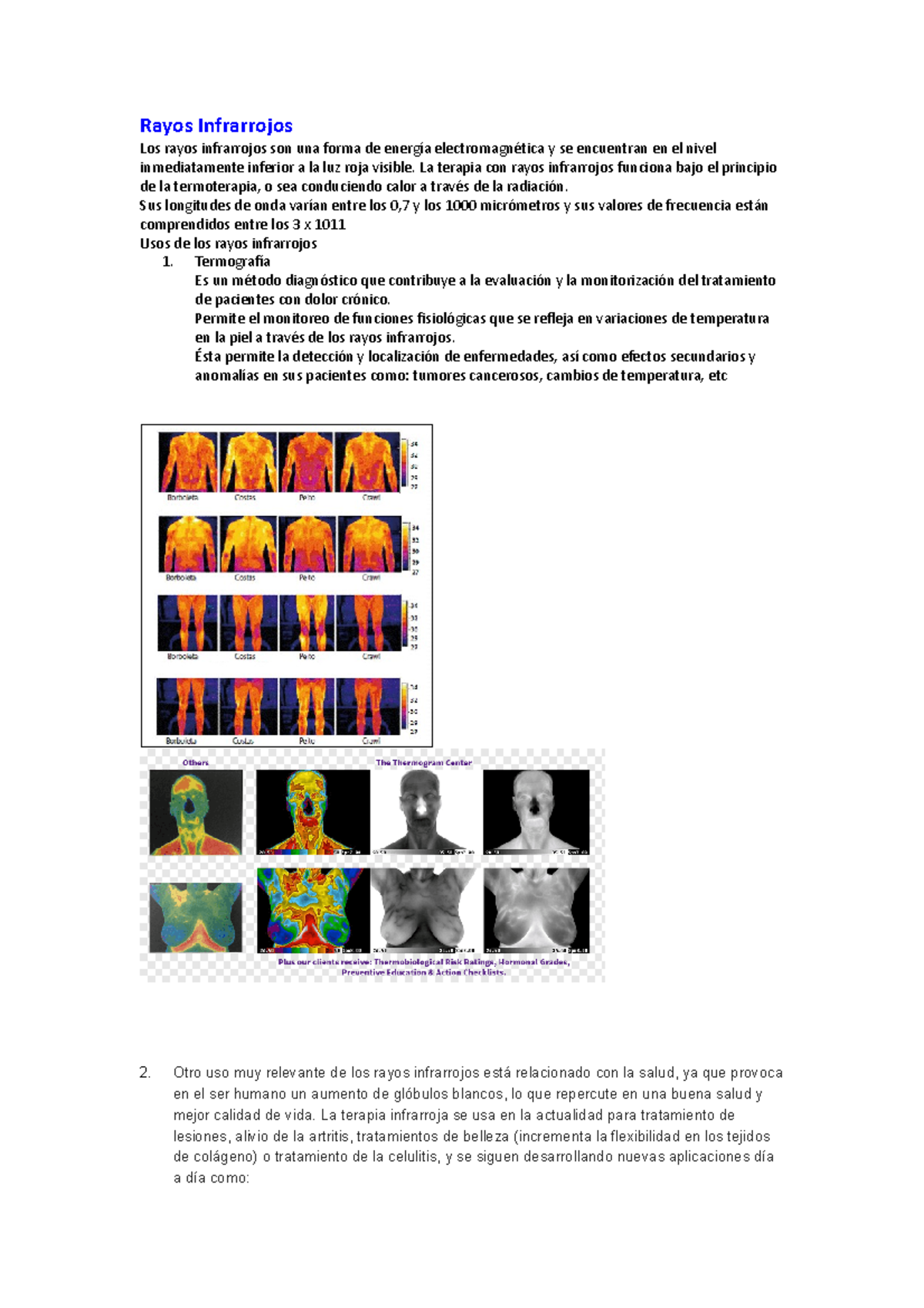 Rayos Infrarrojos - ssss - Rayos Infrarrojos Los rayos infrarrojos son ...