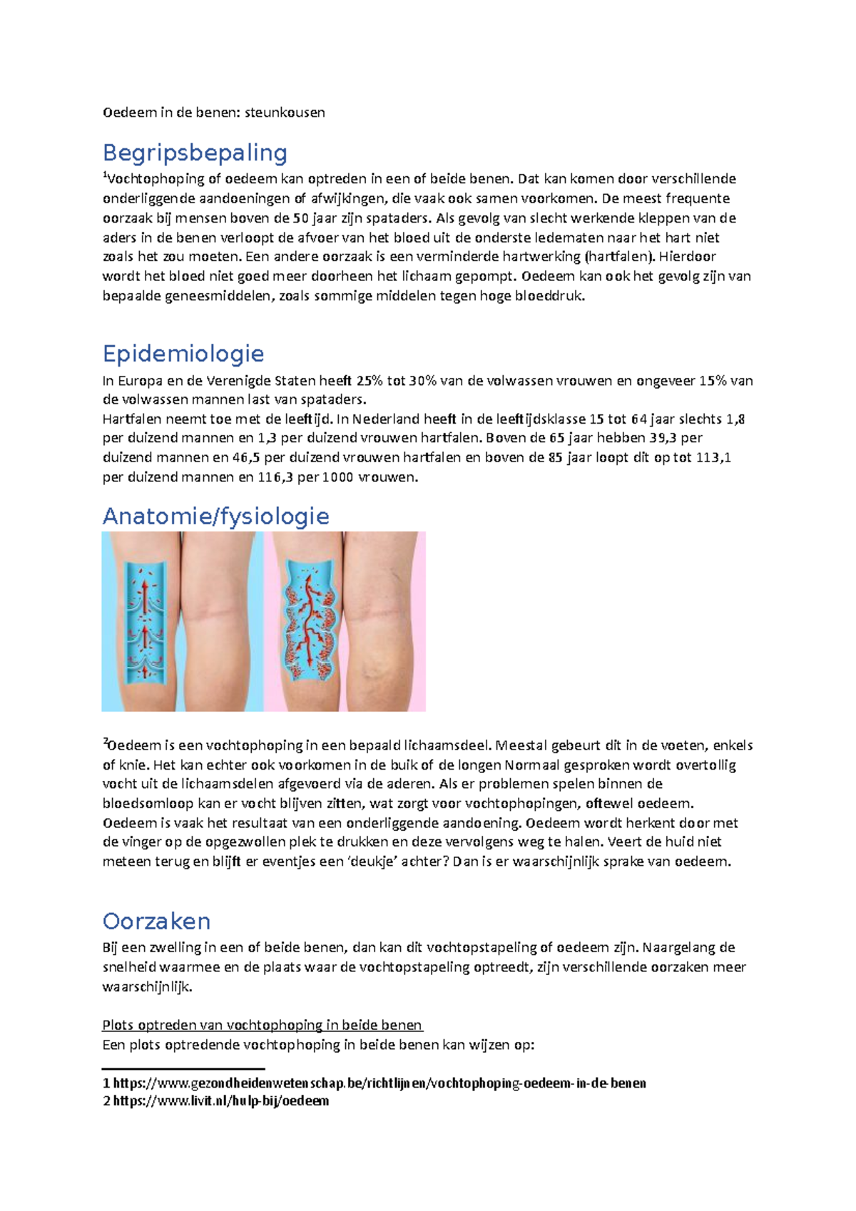 Oedeem in de benen - Rode Loper - Oedeem in de benen: steunkousen ...