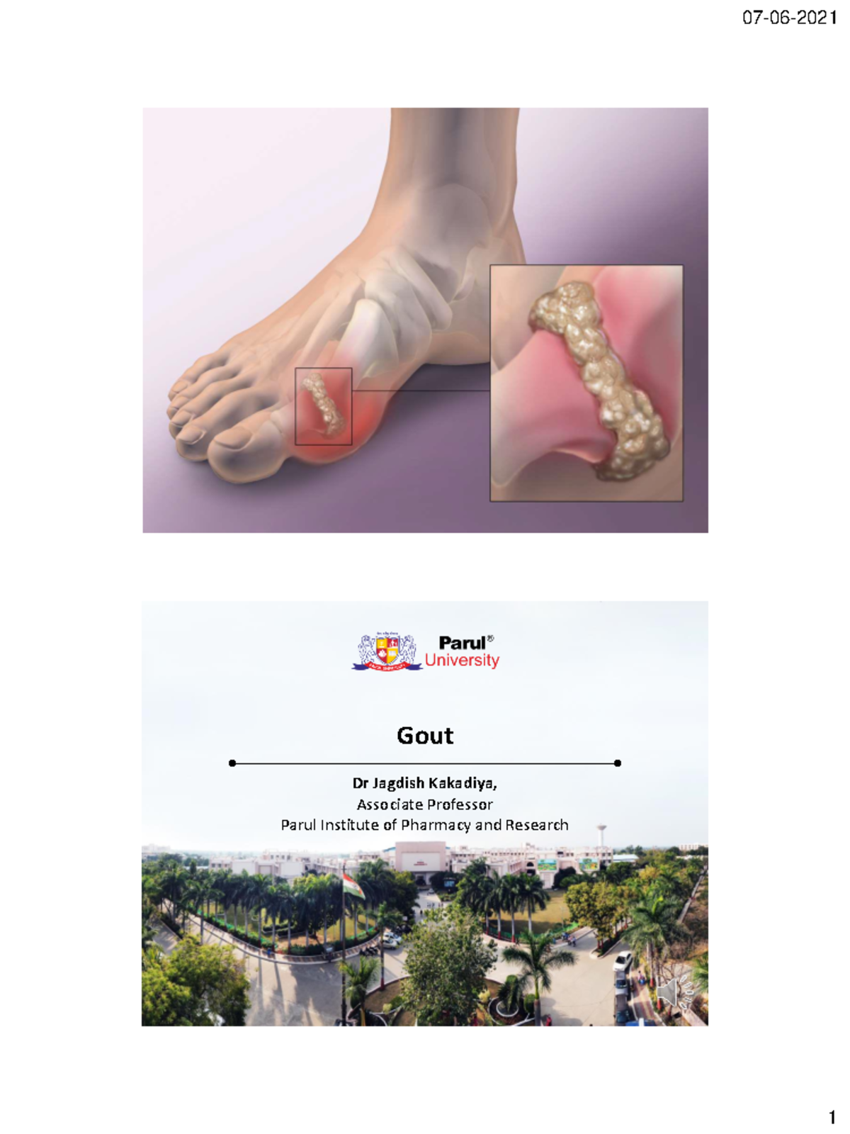 3. Gout - pharmacotherapeutics ii - Difference Difference between RA ...