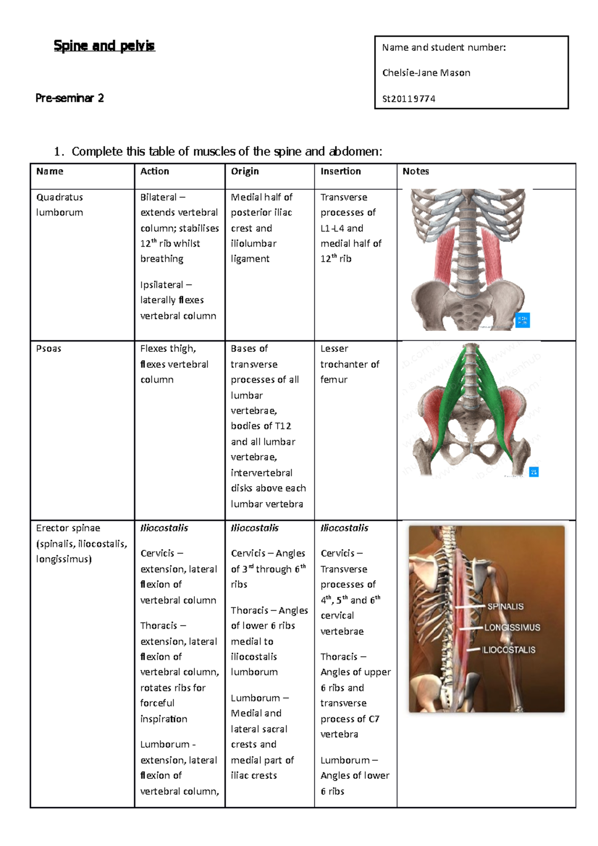 Spine and pelvis 2 - Spine and pelvis Pre-seminar 2 1. Complete this ...
