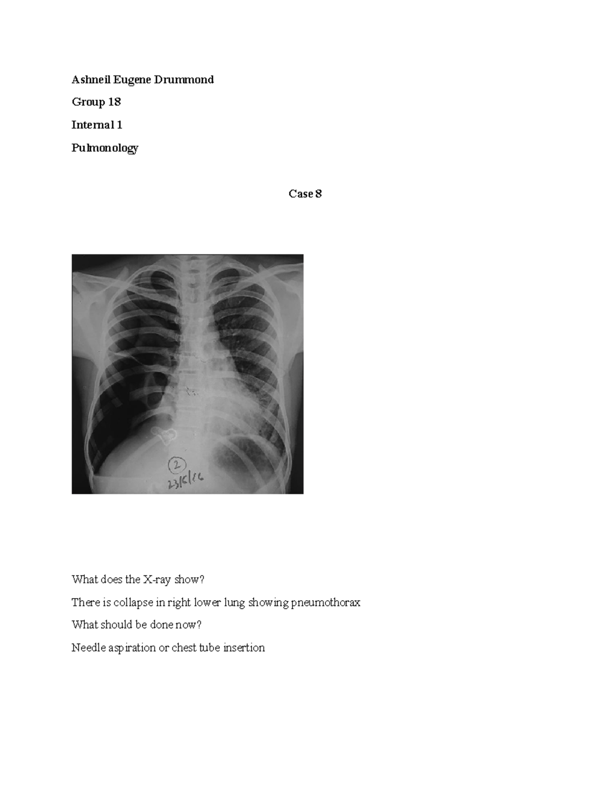 Pulmo quiz with cases - Summary Step-up to Medicine - Ashneil Eugene ...