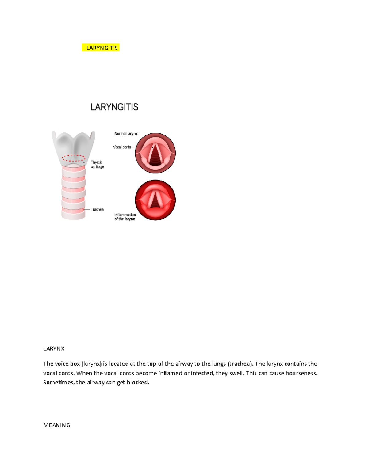 Laryngitis-WPS Office - LARYNGITIS LARYNX The voice box (larynx) is ...