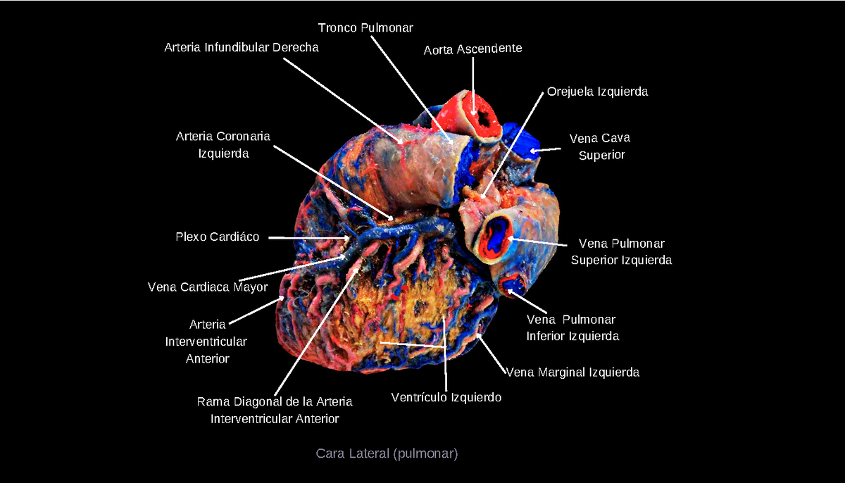 Atlas - anatomia - Arteria Infundibular Derecha Vena Cava Superior Vena ...
