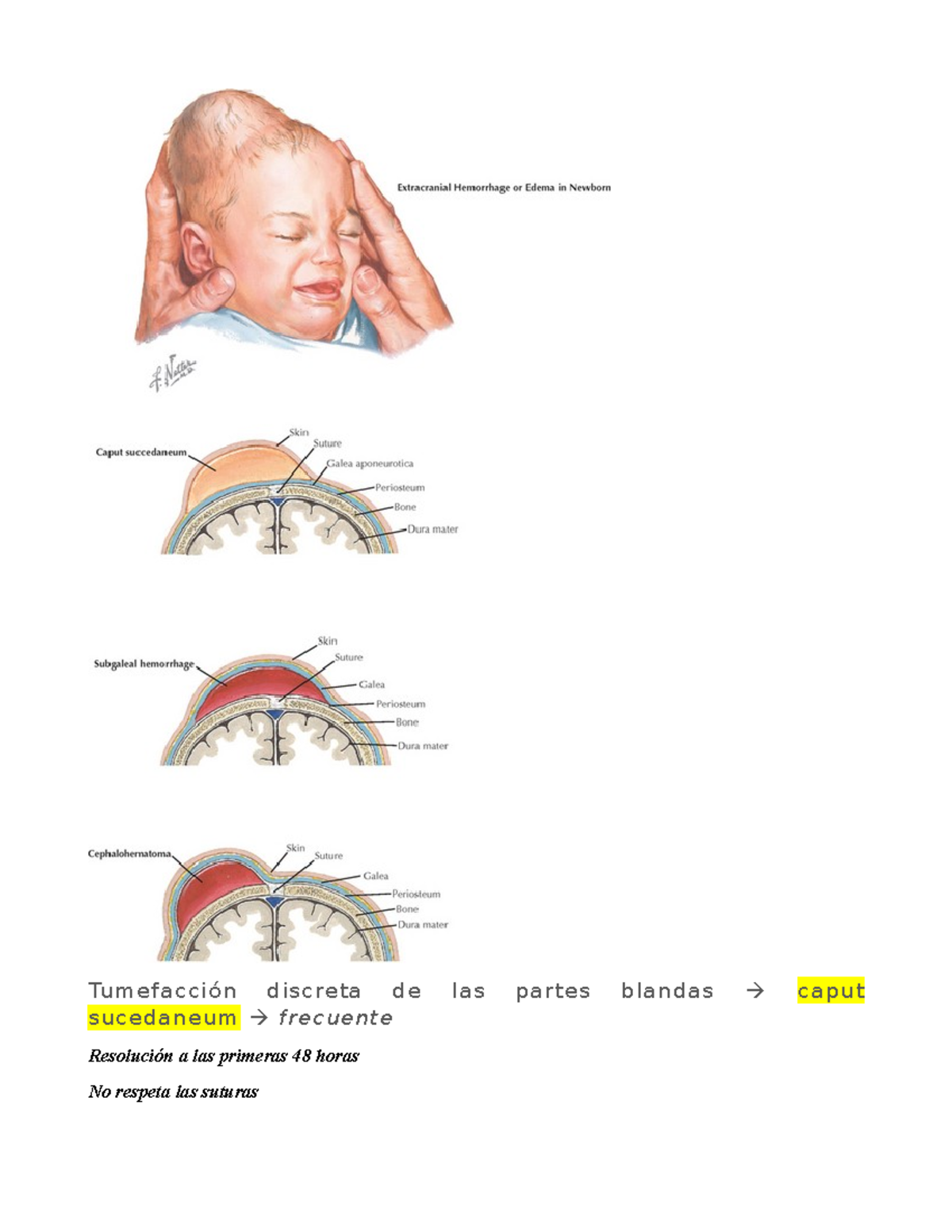 Tumefacción discreta de las partes blandas - Pediatría Del Niño Enfermo ...