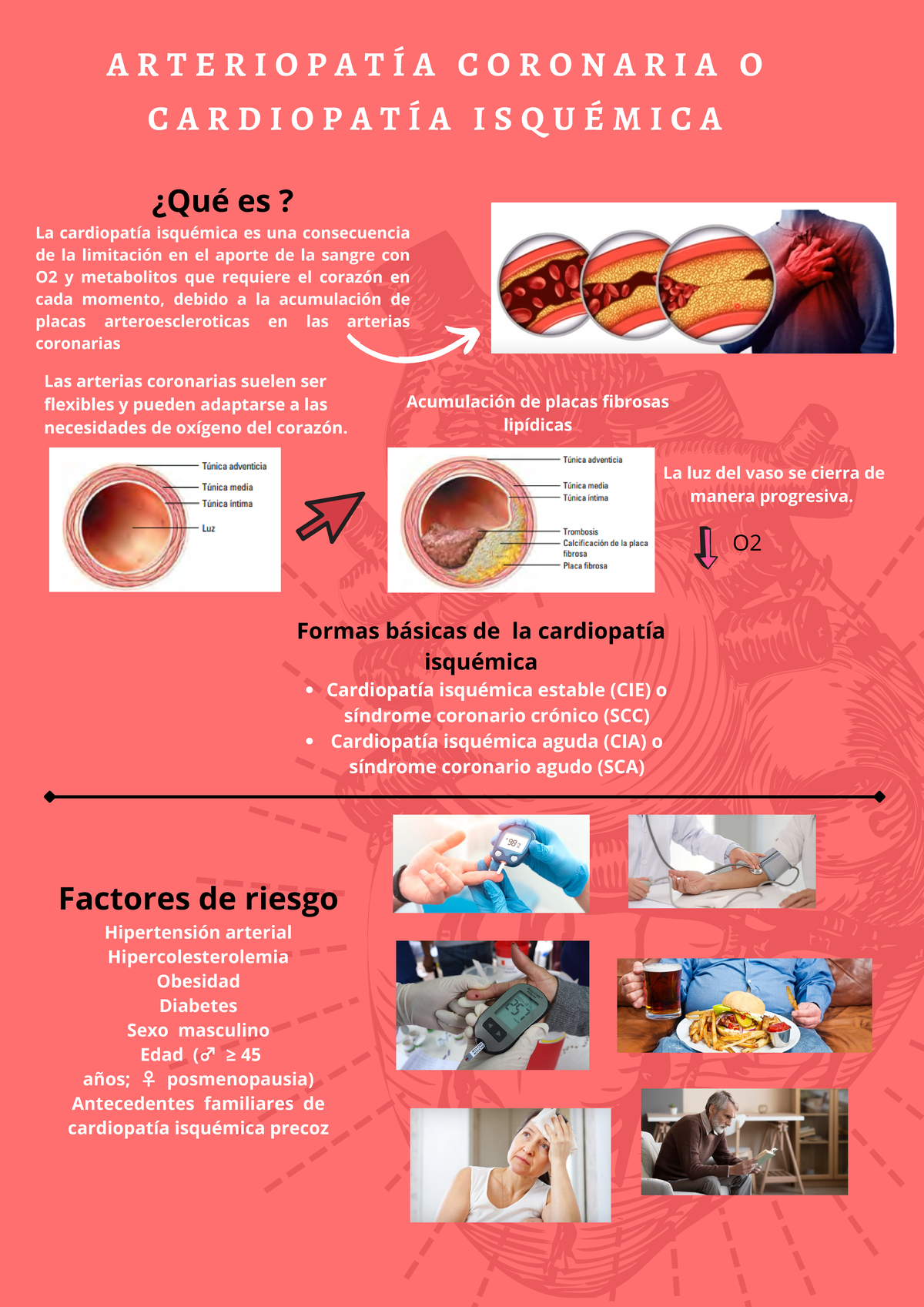 Arteriopat Ía coronaria o cardiopat Ía isqu Émica - A R T E R I O P A T ...