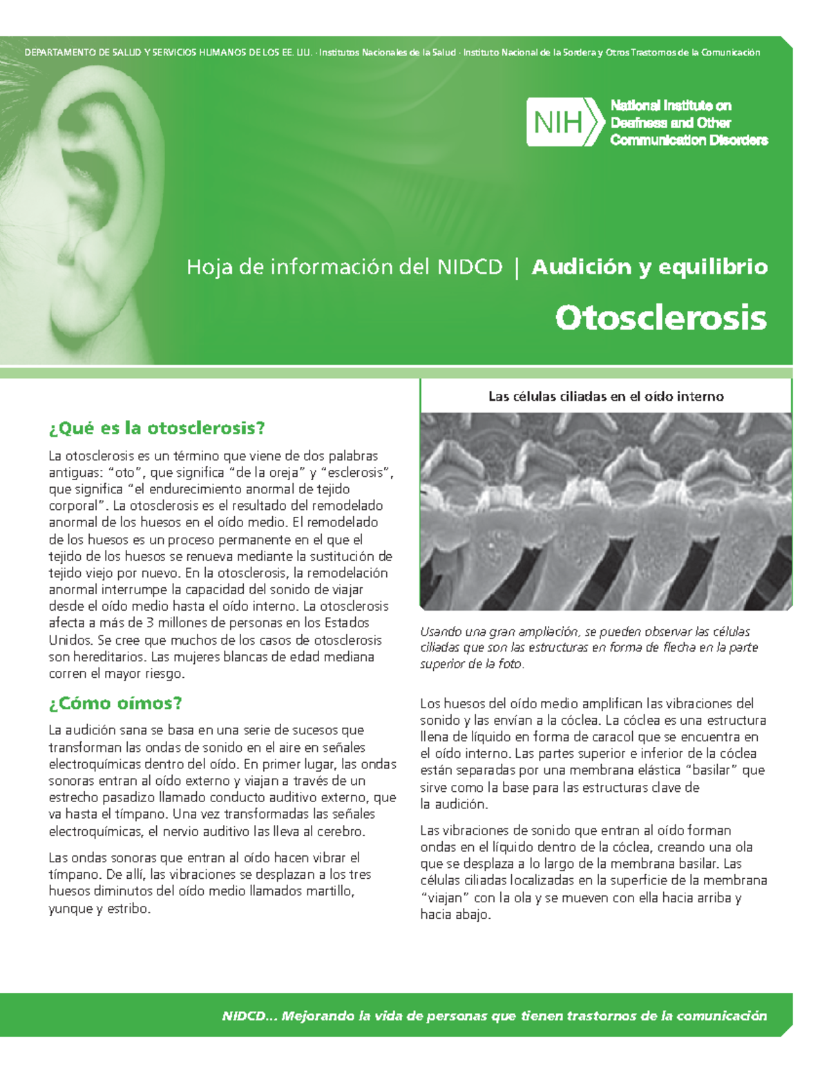 Otosclerosis-Spanish - DEPARTAMENTO DE SALUD Y SERVICIOS HUMANOS DE LOS ...
