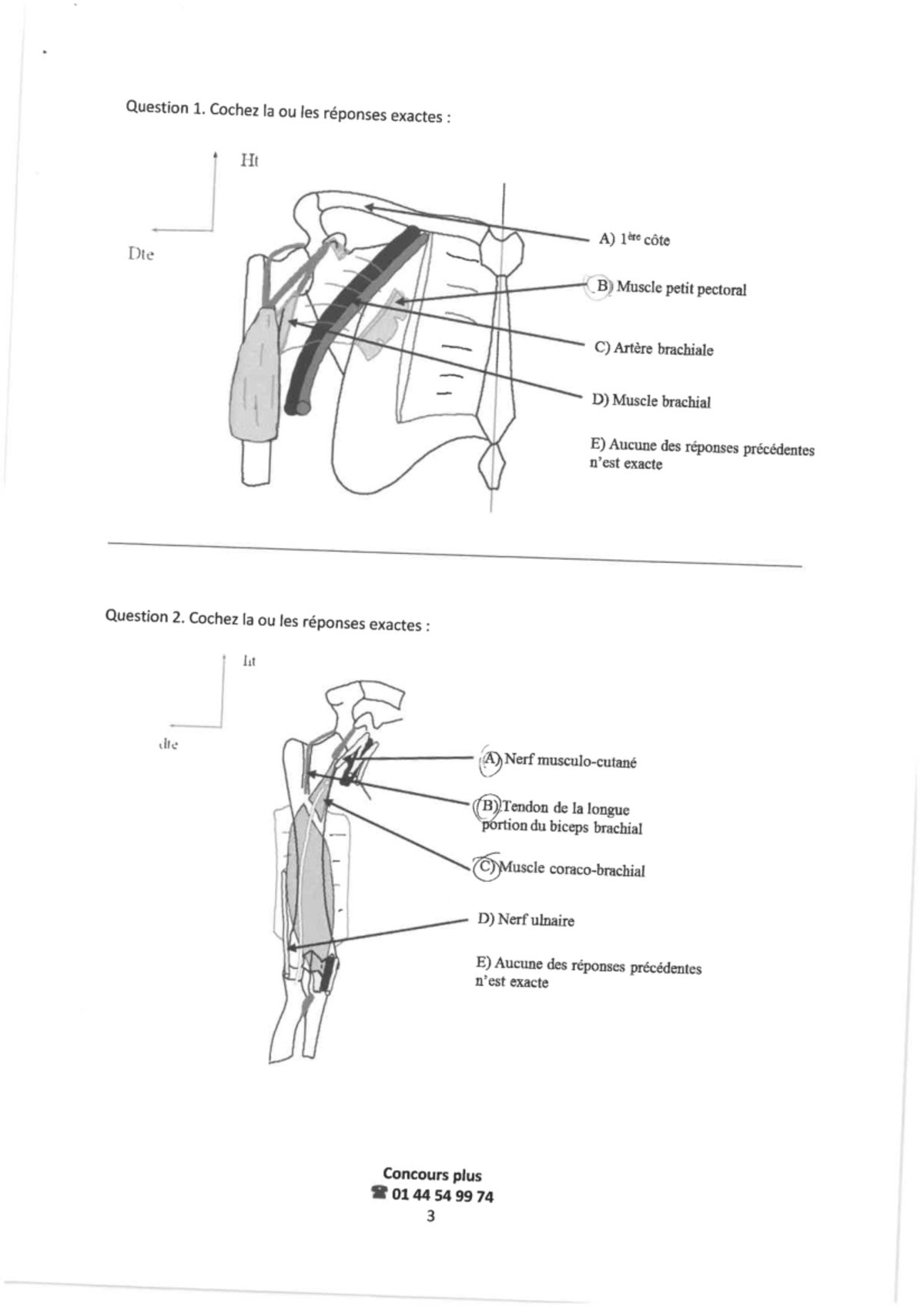 Examen type / pratique 8 Mars 2016, questions et réponses - A) 16“ céte ...