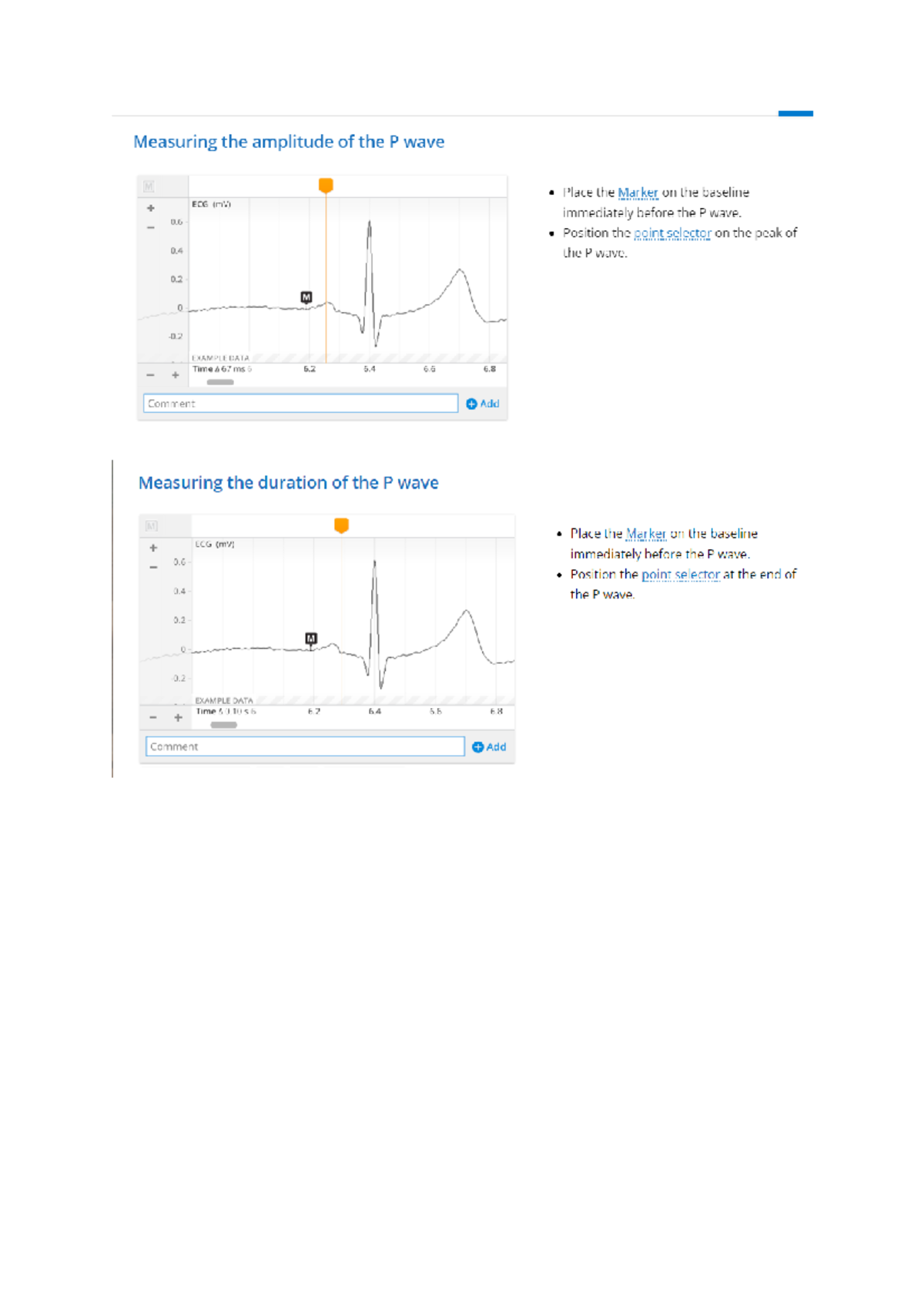 ECG instructions - These are practical instrustions on how to use ...