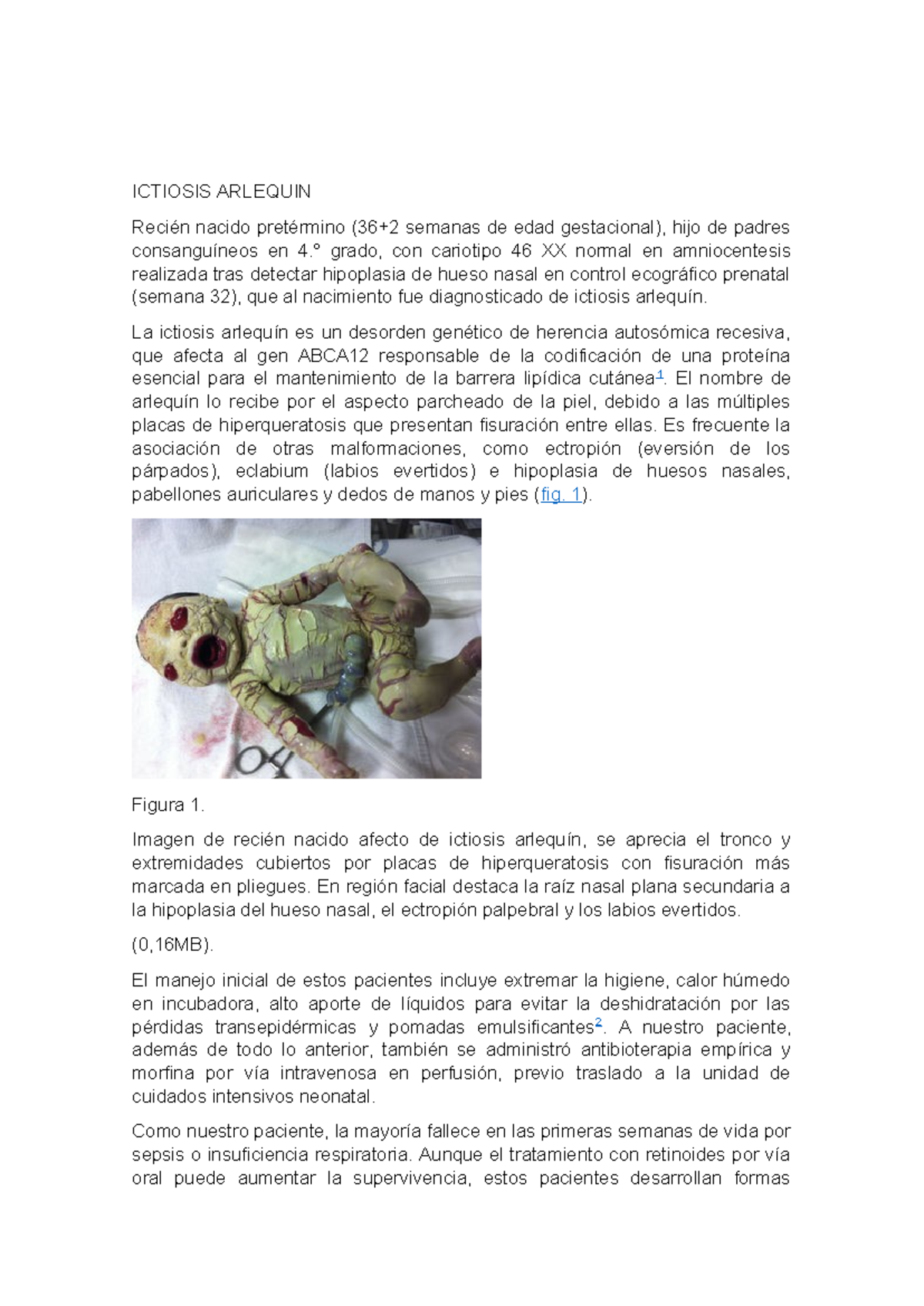 Ictiosis Arlequin - ICTIOSIS ARLEQUIN Recién nacido pretérmino (36+2 ...