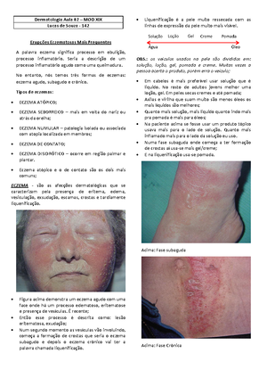 AULA3 - DST (tabela) - Resumo Dermatologia - CANCRO Cancro Duro Goma RY ...