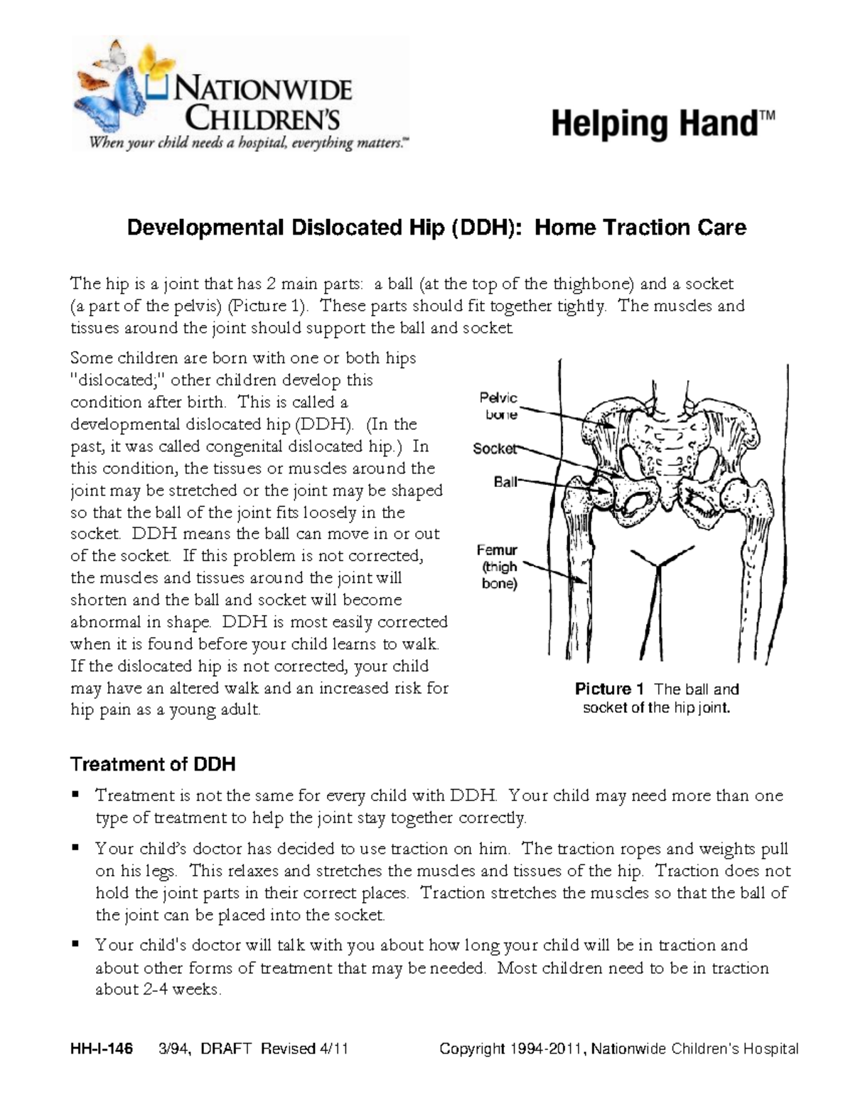 HHI146 - notes on developmental hip dysplasia - Developmental ...