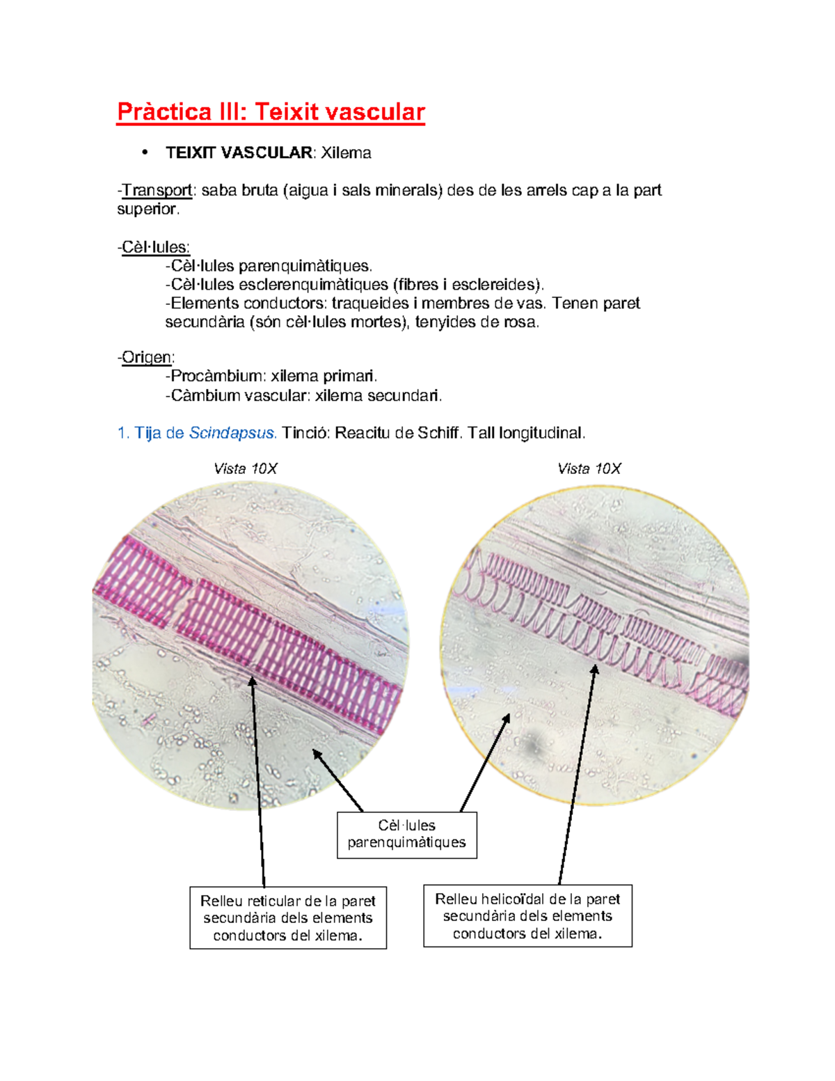 Pràctica 3: Teixit vascular (HV) - Teixit vascular TEIXIT VASCULAR ...