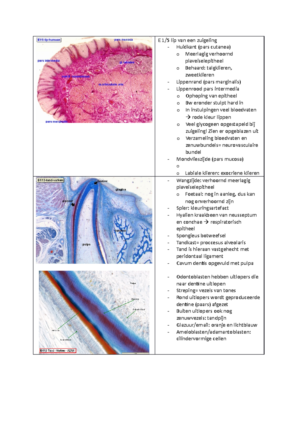Practicum 3 mondholte - E 1/5 lip van een zuigeling - Huidkant (pars ...