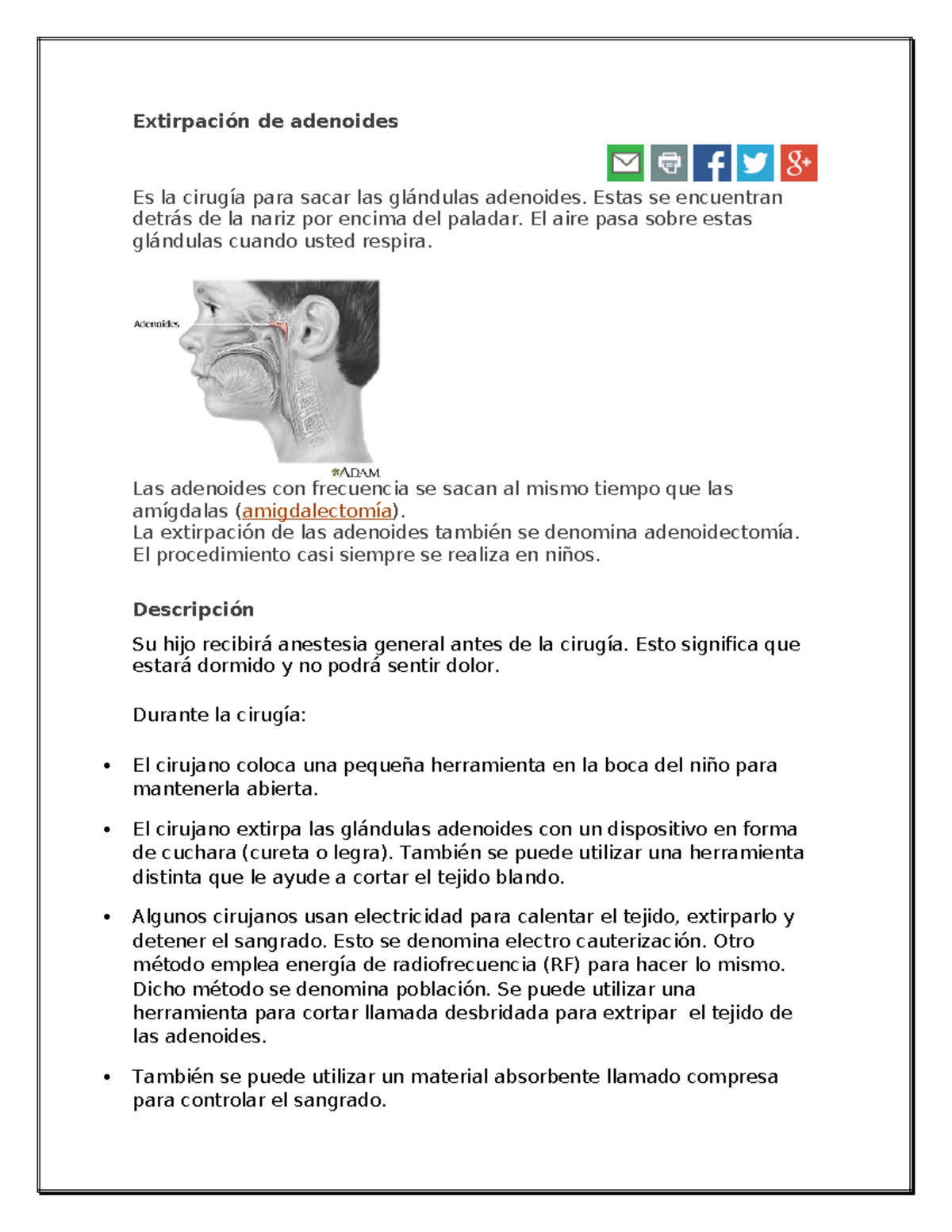 Extirpación de adenoides - Extirpación de adenoides Es la cirugía para ...