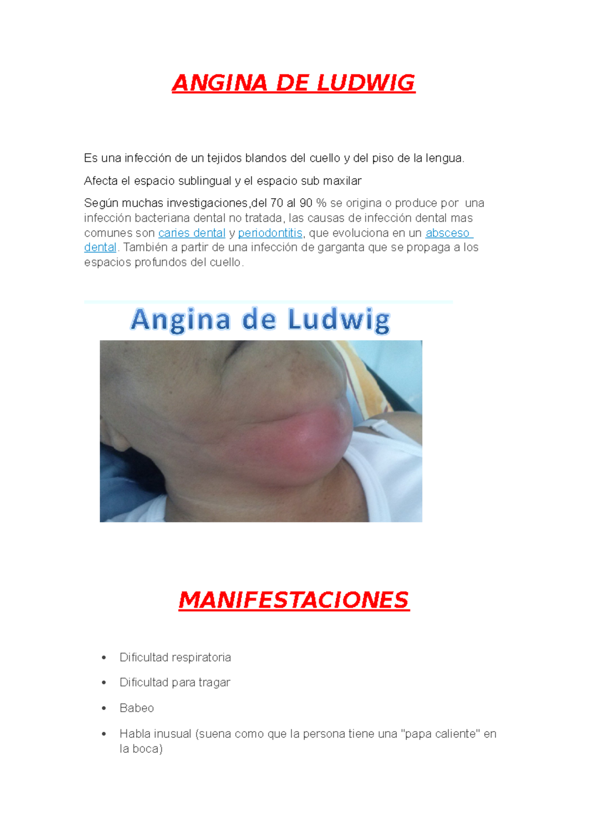 Angina DE Ludwig - ANGINA DE LUDWIG Es una infección de un tejidos ...