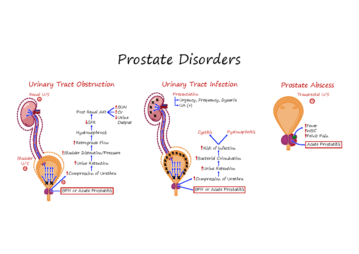 2• Prostate Disorders [Illustrations Key] - Post Renal AKI GFR ...
