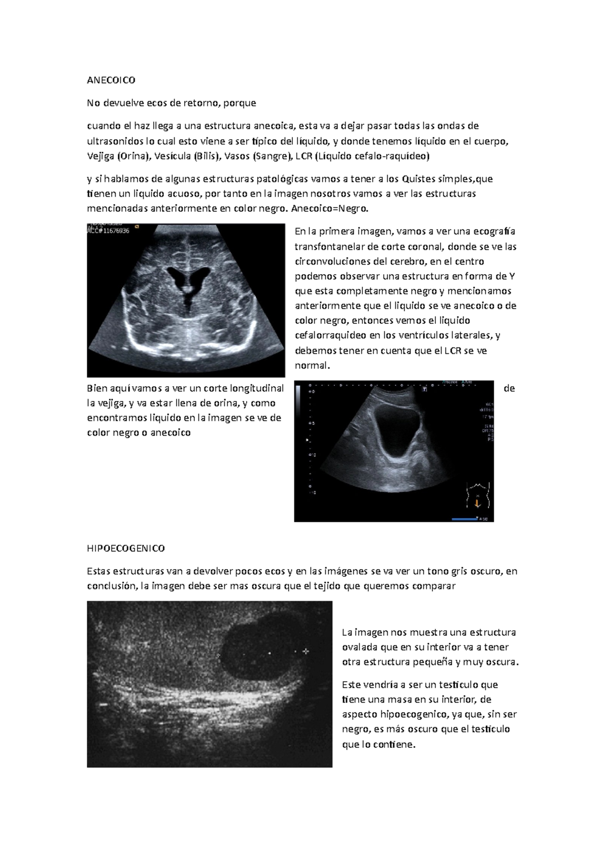 EXPO Resumen - resuemn - ANECOICO No devuelve ecos de retorno, porque ...