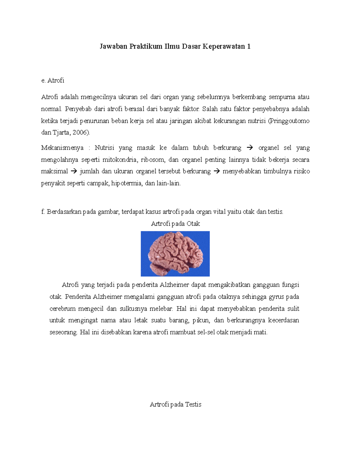 Adaptasi, Jejas, dan Kematian Sel - Jawaban Praktikum Ilmu Dasar ...