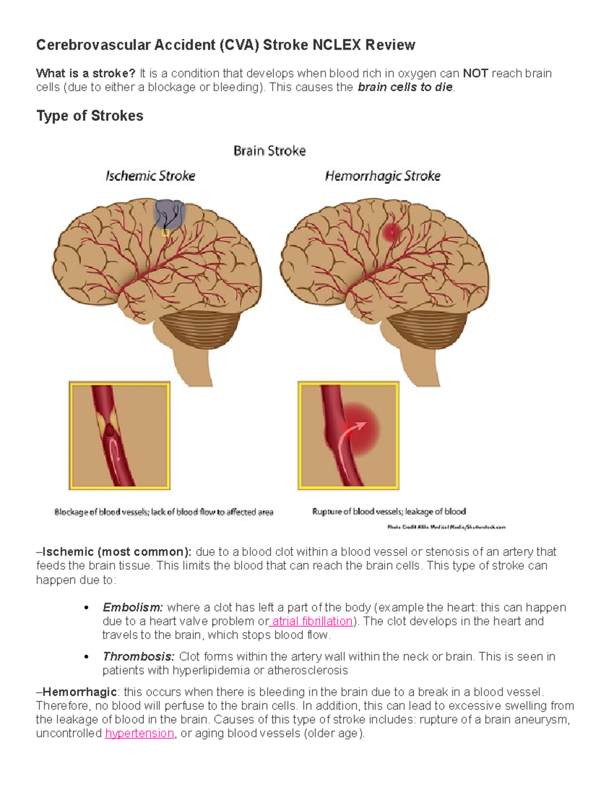 Cerebrovascular Accident - Nclex - Cerebrovascular Accident (CVA ...