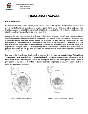 rx Pelvis tabla - @ Signo de risser: maduración de cartílagos en ...