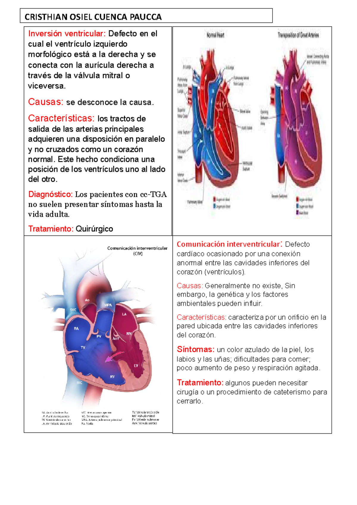 Inversion Ventricular Y Comunicacion Interventricular - CRISTHIAN OSIEL ...