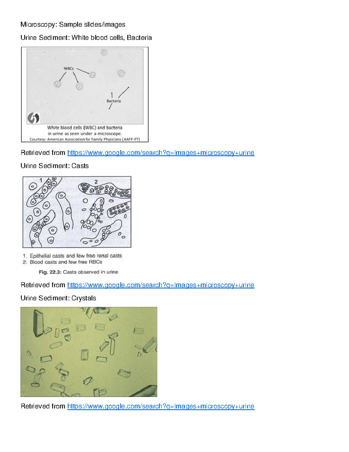 2017 CSI Microscopy Sample Slides - Microscopy: Sample slides/images Urine Sediment: White blood ...