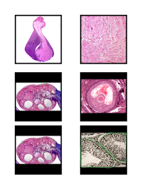 Ch 7 - Bone Tissue - Lecture notes from chapter - L Bone Chapter 7:bone ...