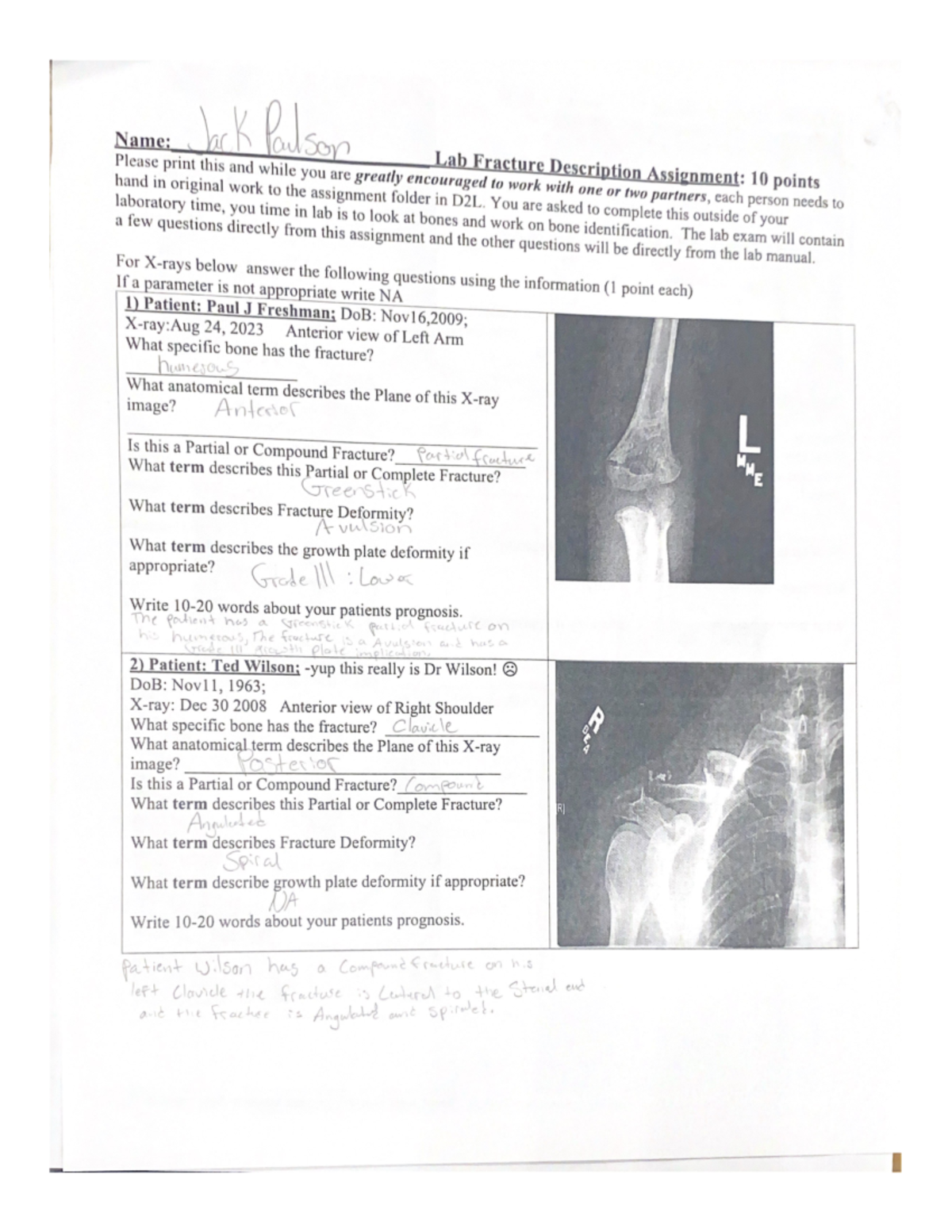 Lab Fracture Description Assignment - BIOL 211 - Studocu