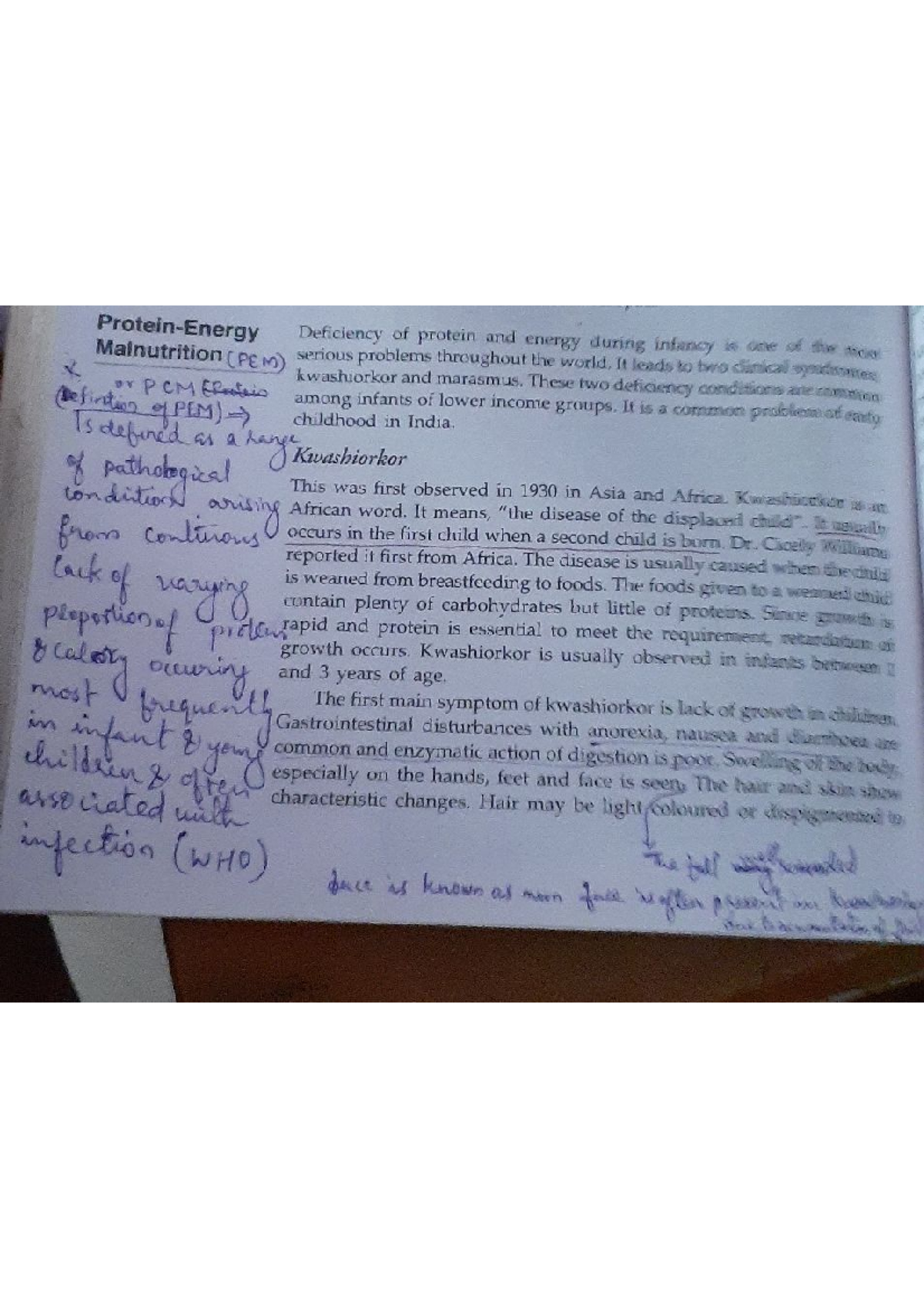 Protein energy malnutrition - Bsc nursing - Studocu