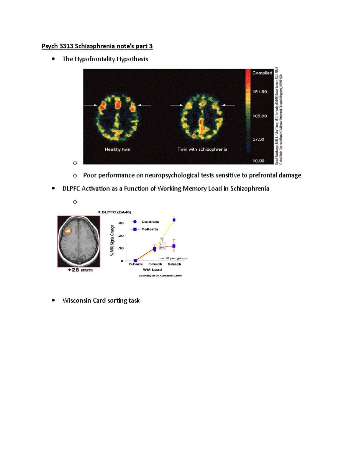 Psych 3313 Schizophrenia note part 3 - Psych 3313 Schizophrenia note’s ...