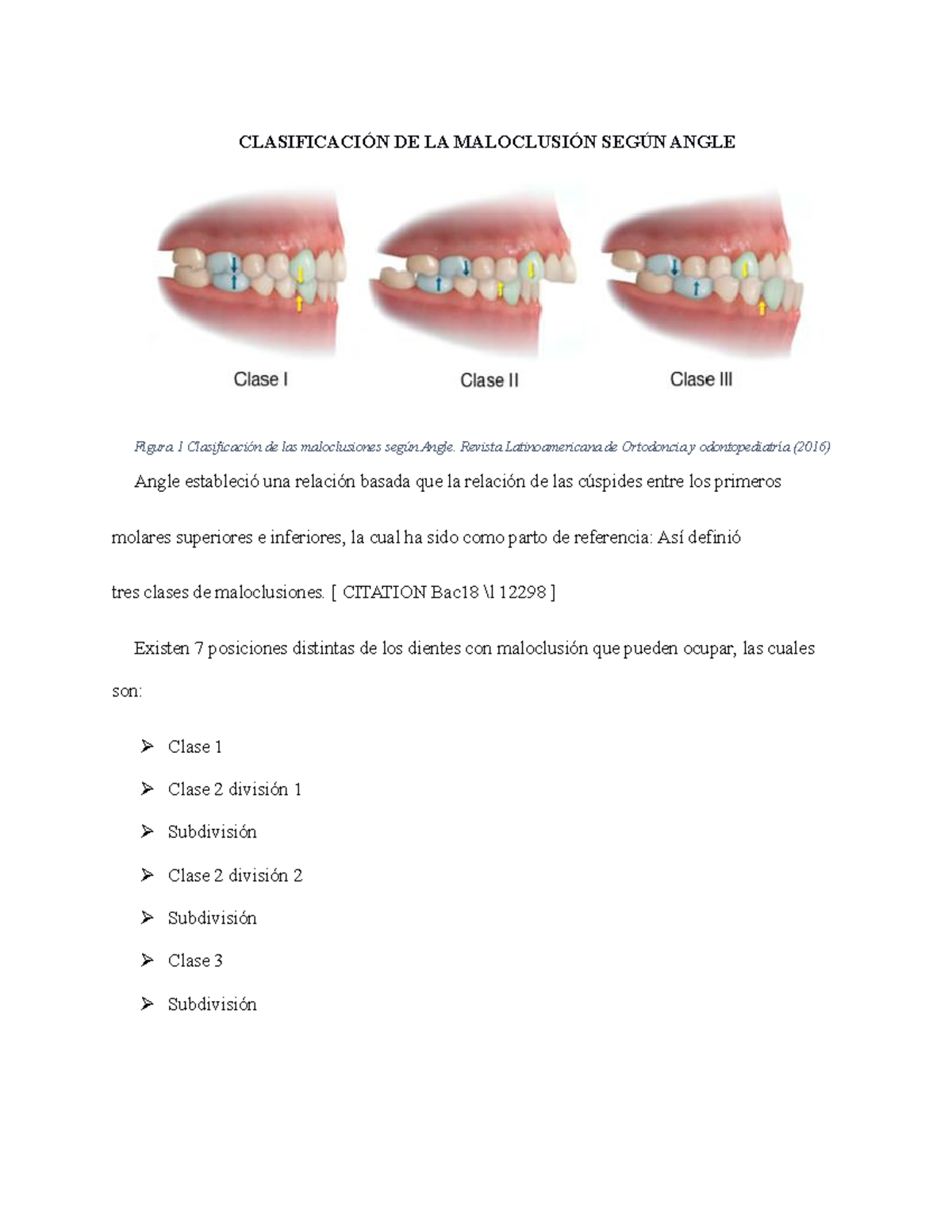 Clasificación de Angle en ortodoncia - CLASIFICACIÓN DE LA MALOCLUSIÓN ...