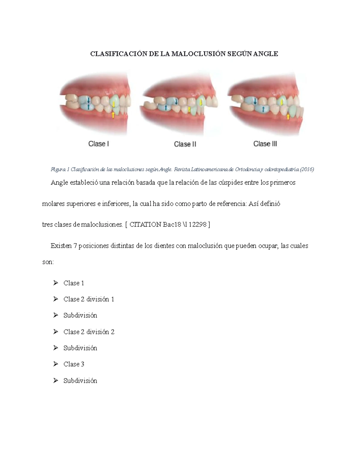 Tarea #1-2do parcial (Placa con tornillo de expansión bilateral y unilateral) - Aparatología ...