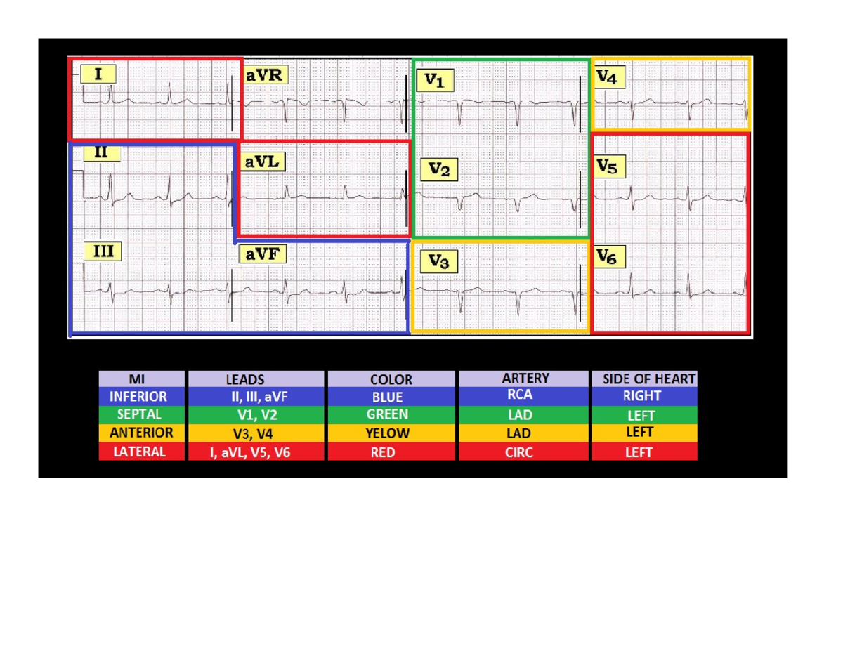 12 lead EKG interpretation - NUrS 40012 - Studocu