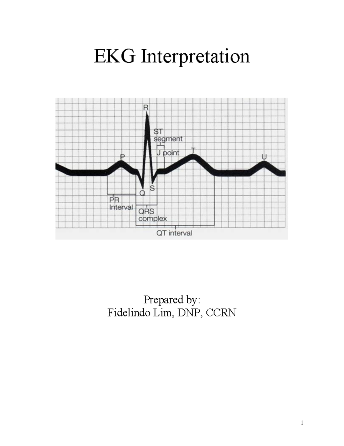EKG Interpretation Handout - Week 2 Lecture - EKG Interpretation ...