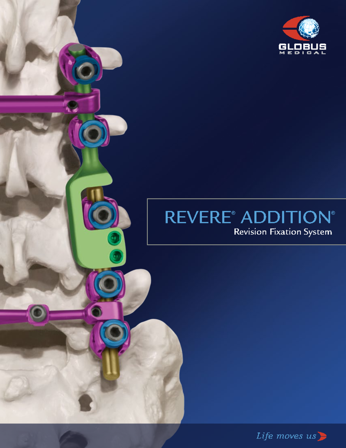 Globus - Revere Addition (revision system) - REVERE ® ADDITION ...