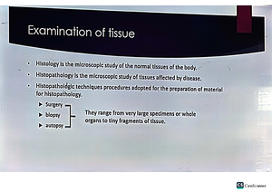 Pituitary - Definition of Disease Pituitary Adenoma A pituitary adenoma ...